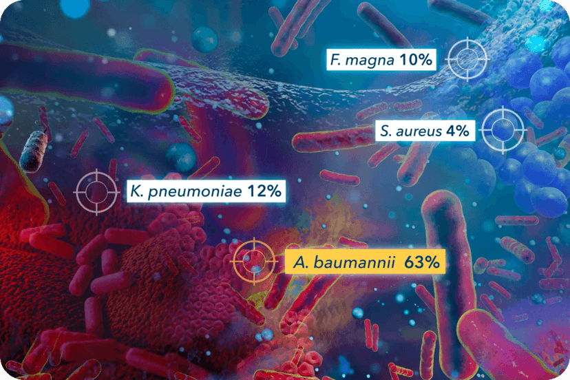 Discover More about MicroGenDX
